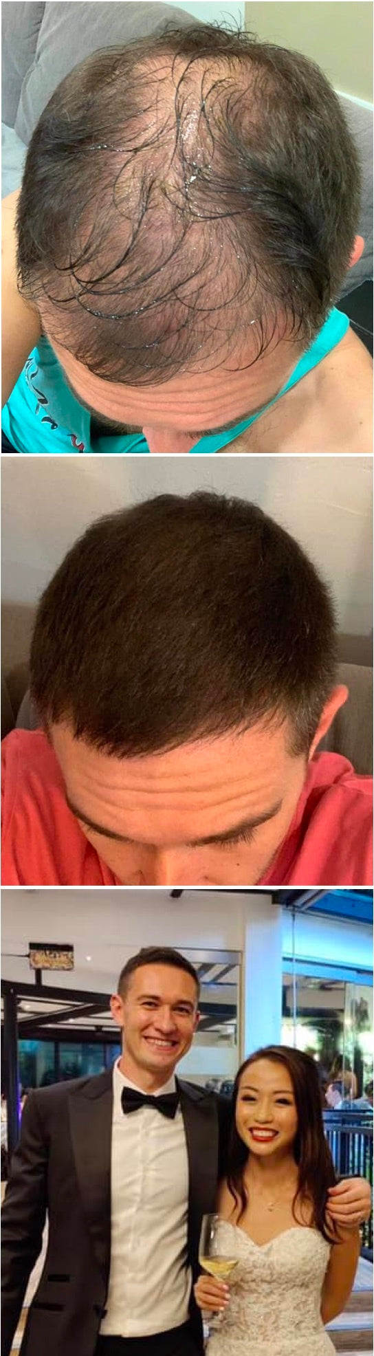 ADEGEN | Advanced Hair Growth Solutions Backed By Science