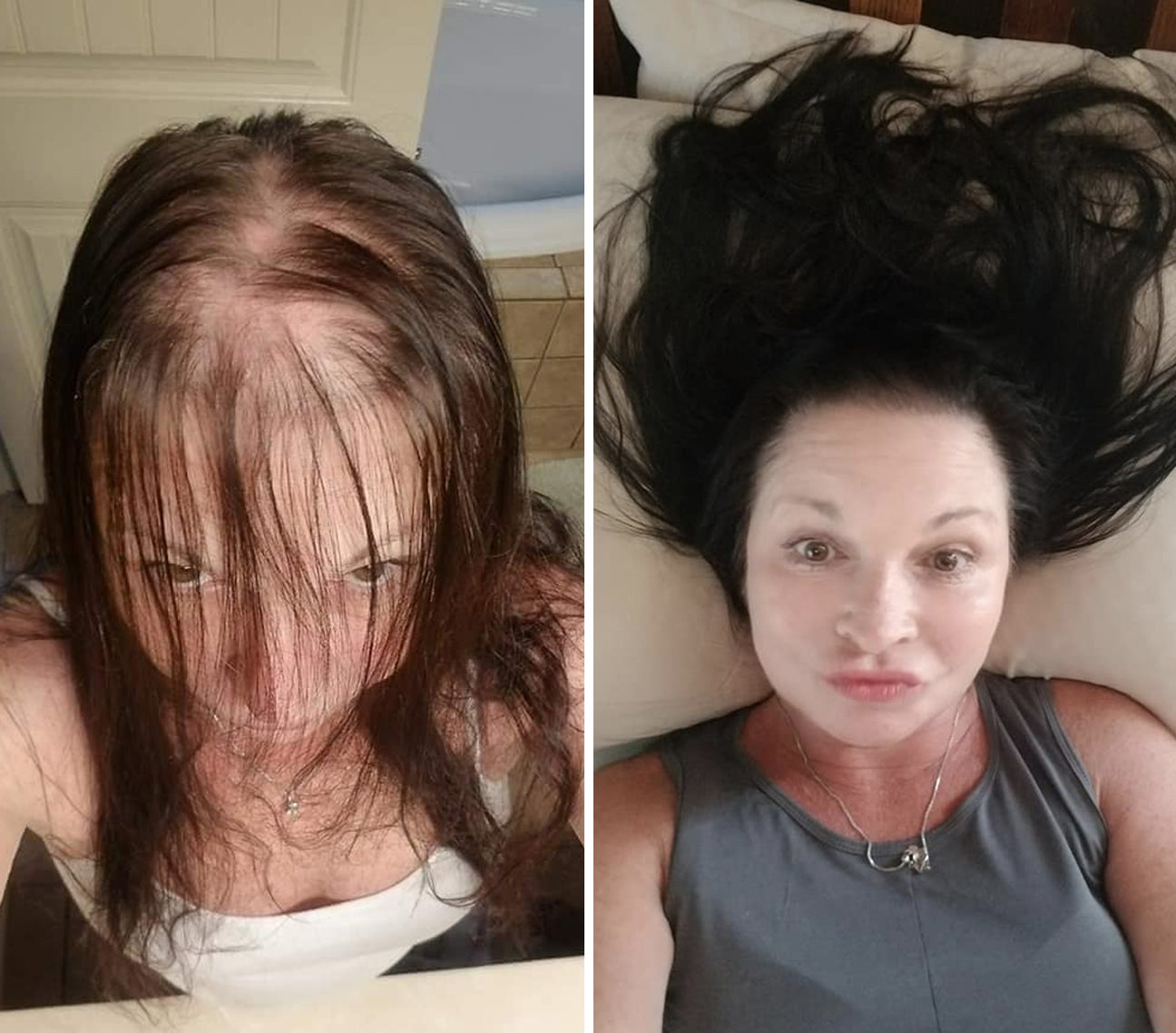 ADEGEN | Advanced Hair Growth Solutions Backed By Science